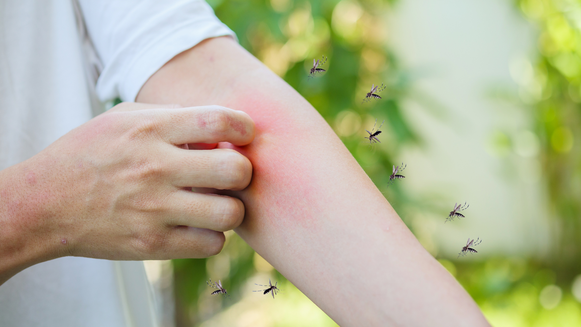 World Mosquito Day: Why Protection Matters More Than Ever – Less Mosquito